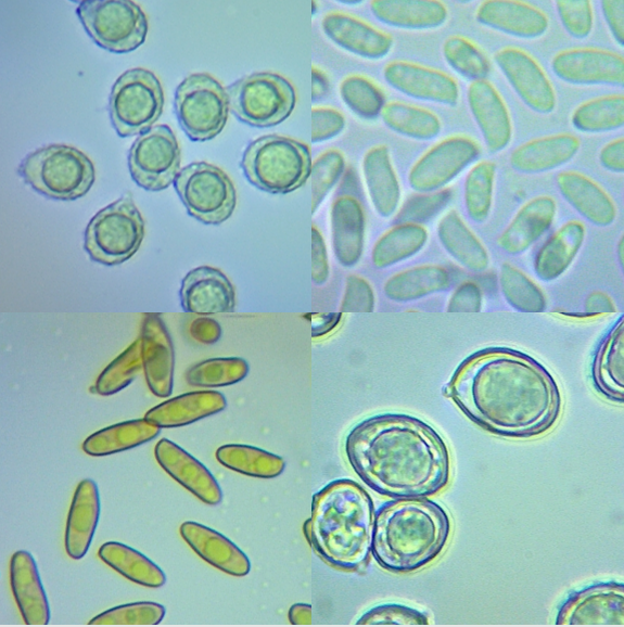 Fungi Friday - More Fungal Spore Photography