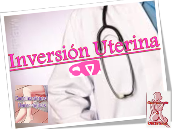 Complicaciones Hemorrágicas: Inversión Uterina. | PeakD
