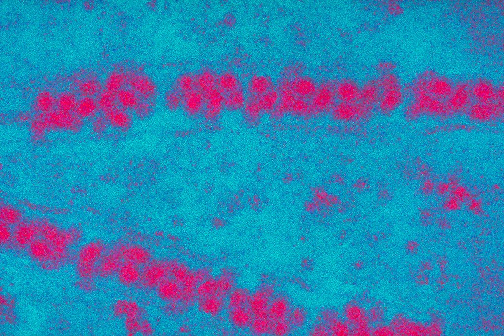 Japanese Encephalitis Virus; A Mosquitoe Borne Disease — Hive