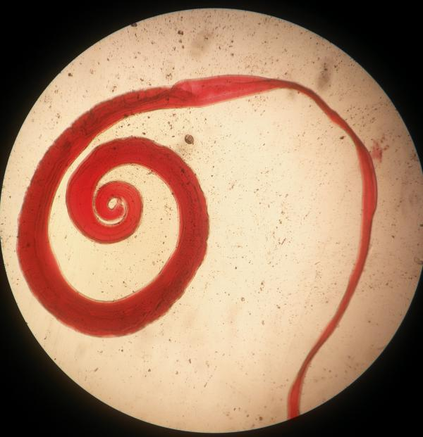 Tricocefalosis: Clínica, diagnóstico y tratamiento + CASO CLÍNICO de ...