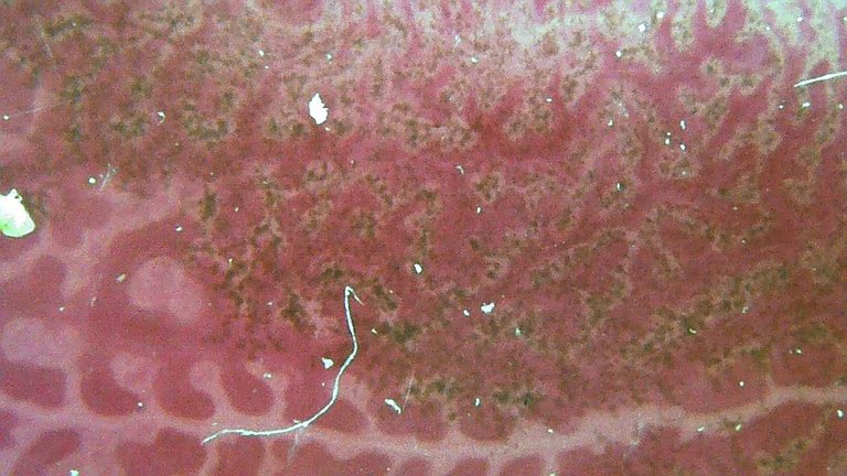 Life Cycle of Fasciola hepatica and Pathogenesis of Fascioliasis — Hive